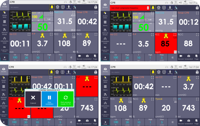 Cardio-Pulmonary Resuscitation Ventilation (CPR) mode in UVENT-S ICU ...