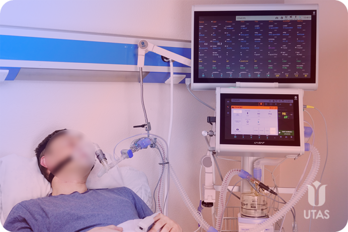 Confident Mechanical Ventilation Control and Enhanced Visualization on ...