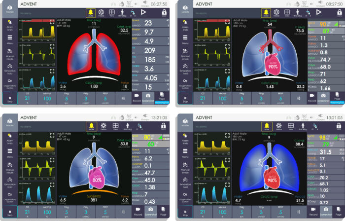 How to improve clinical decision-making in ICU using lung monitoring ...